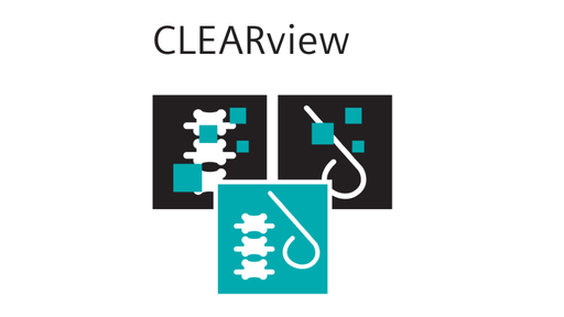 CARE+CLEAR in Interventional Imaging - Siemens Healthineers