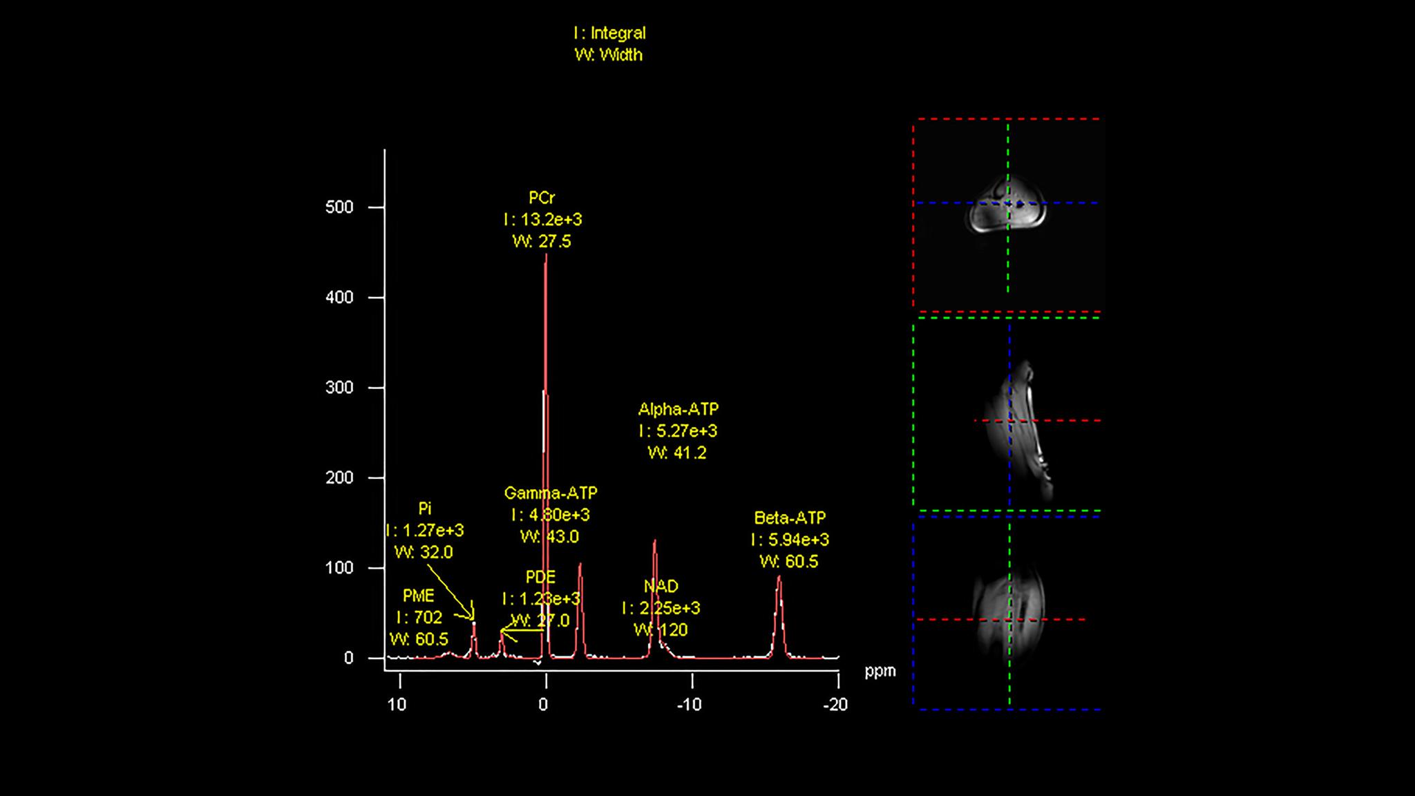 MAGNETOM Terra – 7T MRI Scanner - Siemens Healthineers India