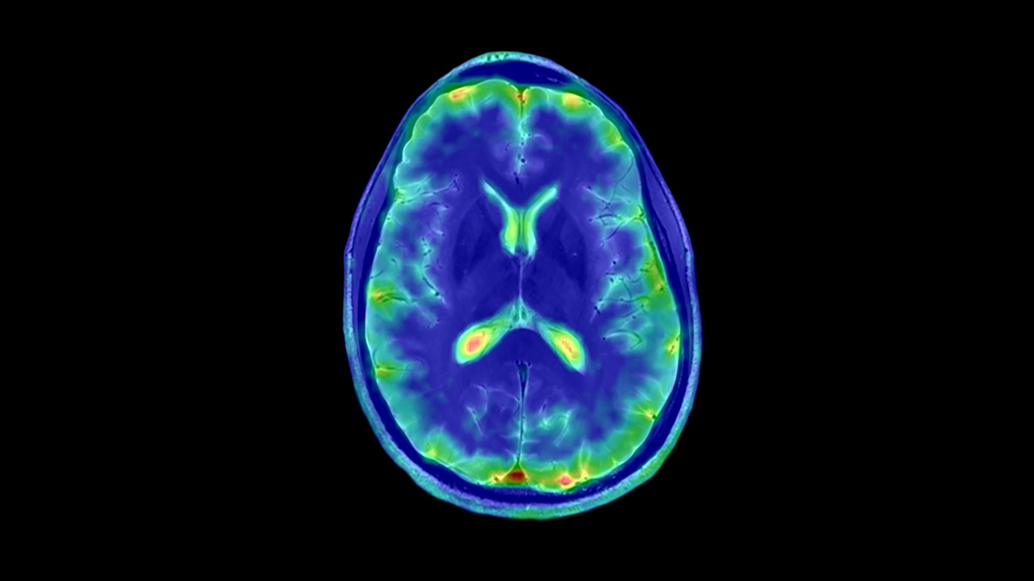 MAGNETOM Terra – 7T MRI Scanner - Siemens Healthineers India