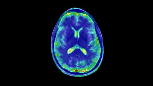 MAGNETOM Terra – 7T MRI Scanner - Siemens Healthineers India