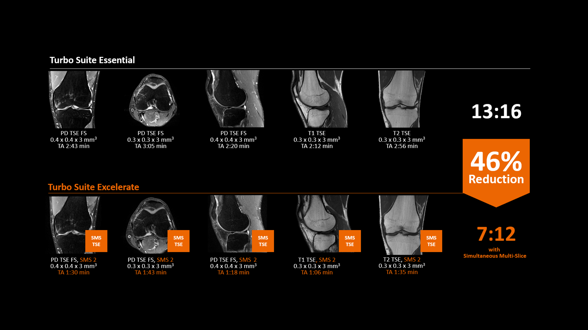 Turbo Suite - Siemens Healthineers Magyarország