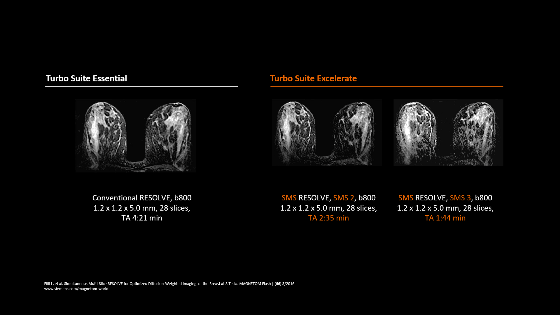 Turbo Suite - Siemens Healthineers