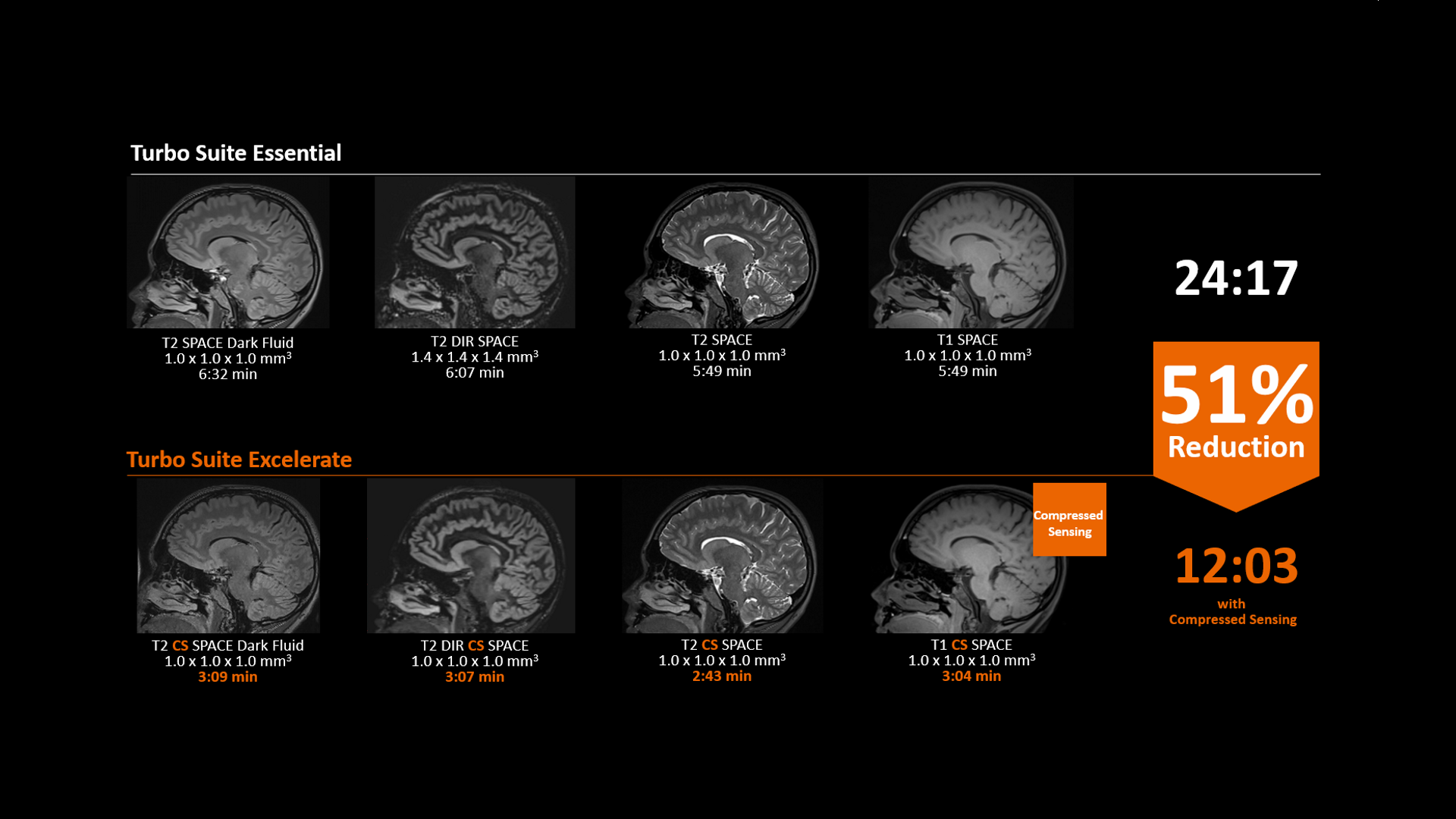 Turbo Suite - Siemens Healthineers
