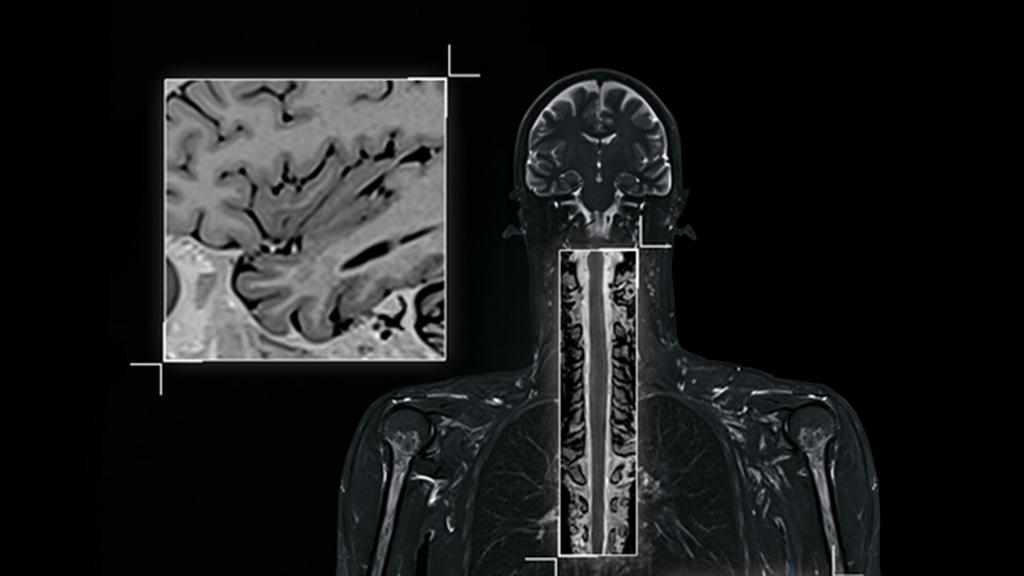 MAGNETOM Prisma - MRI Scanner - Siemens Healthineers