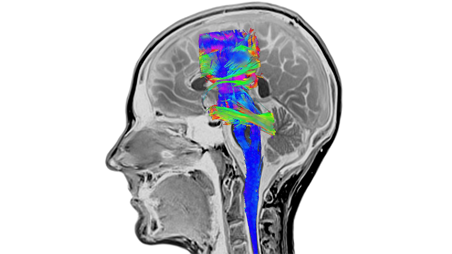 MAGNETOM Prisma - MRI Scanner - Siemens Healthineers