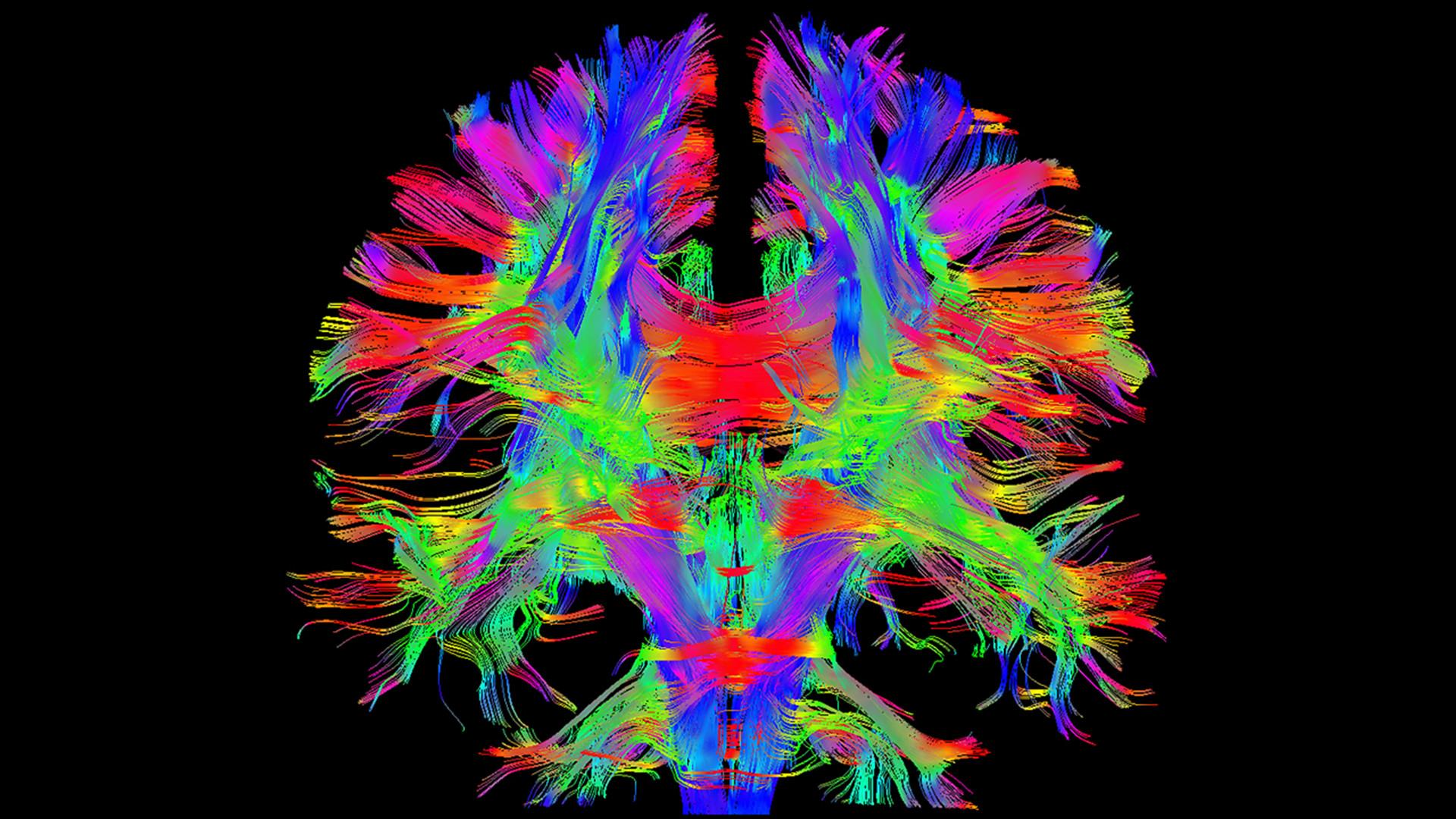 MAGNETOM Prisma - MRI Scanner - Siemens Healthineers