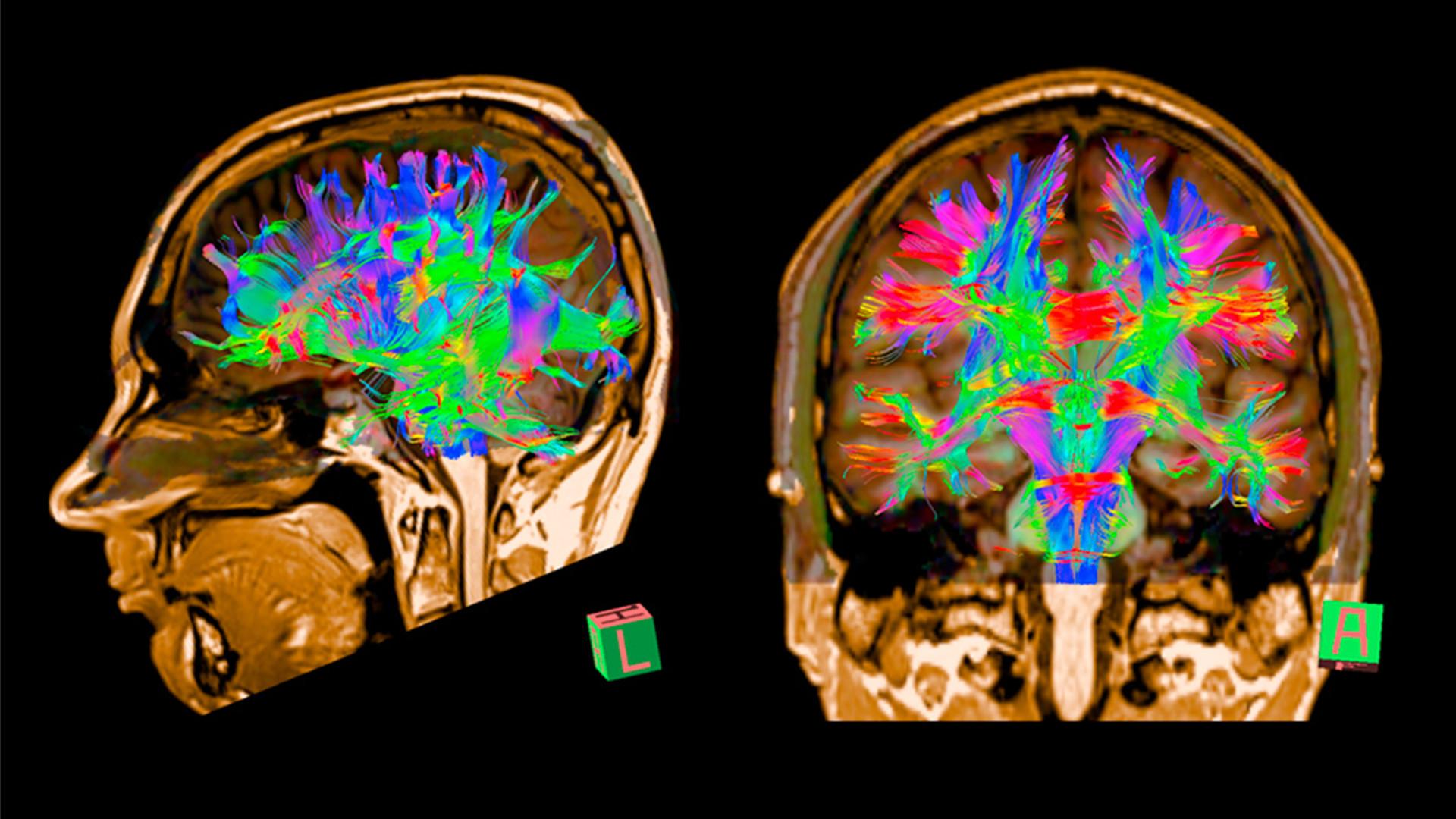 MAGNETOM Prisma - MRI Scanner - Siemens Healthineers