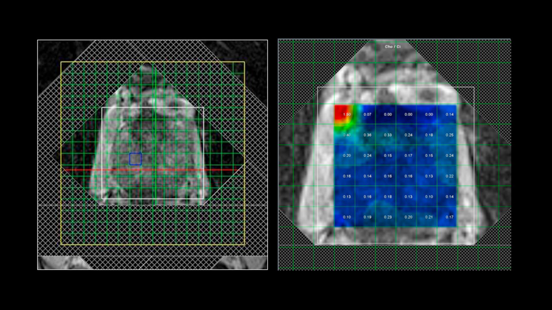 MAGNETOM Prisma - MRI Scanner - Siemens Healthineers Schweiz
