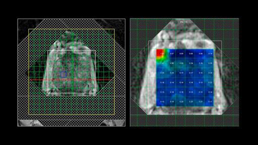 MAGNETOM Prisma - MRI Scanner - Siemens Healthineers Česká republika