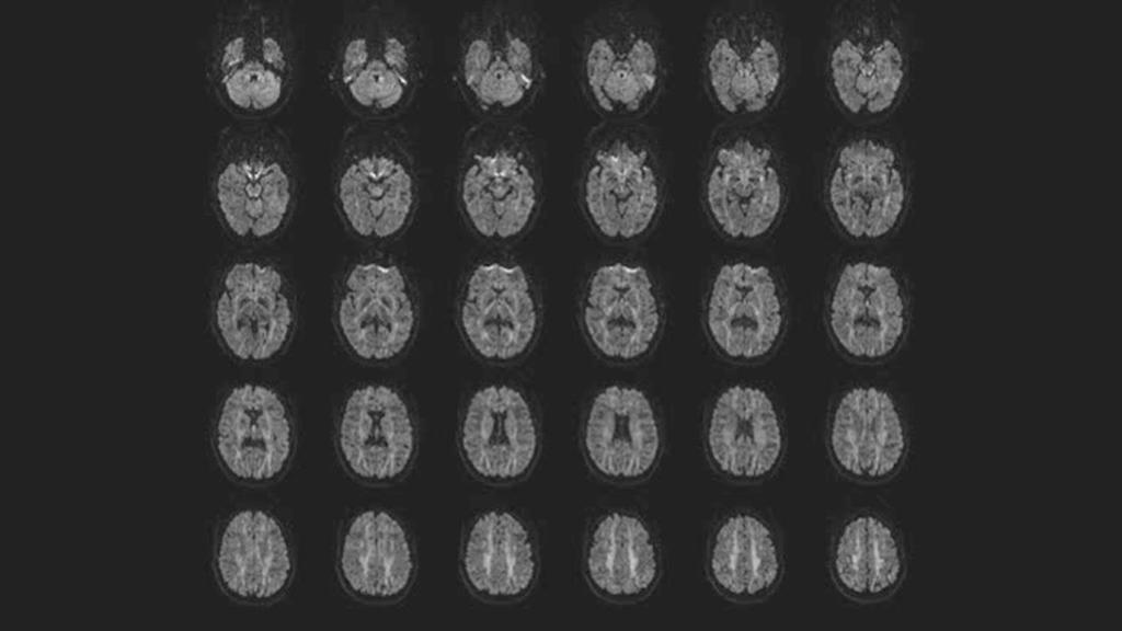 MAGNETOM Prisma - MRI Scanner - Siemens Healthineers