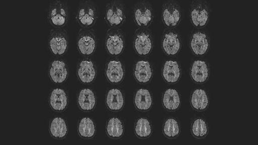 MAGNETOM Prisma - MRI Scanner - Siemens Healthineers