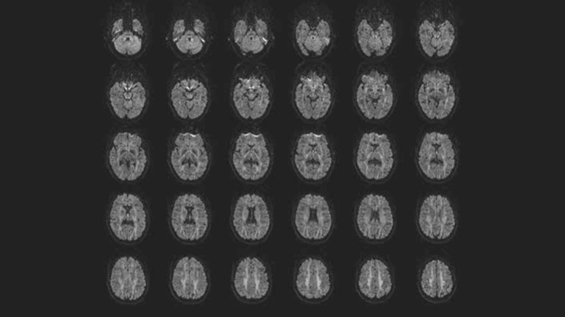 MAGNETOM Prisma - MRI Scanner - Siemens Healthineers