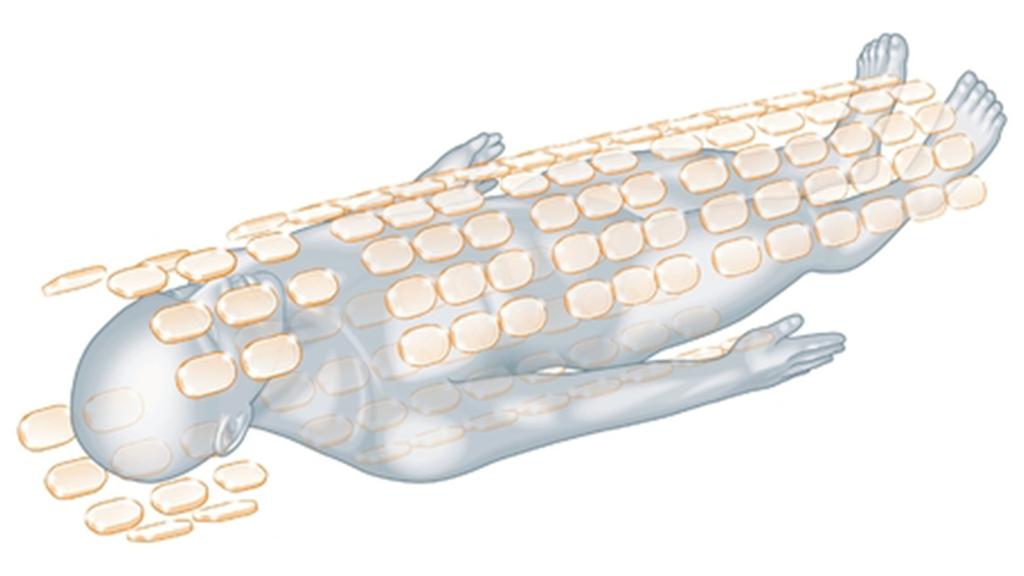 MAGNETOM Prisma - MRI Scanner - Siemens Healthineers