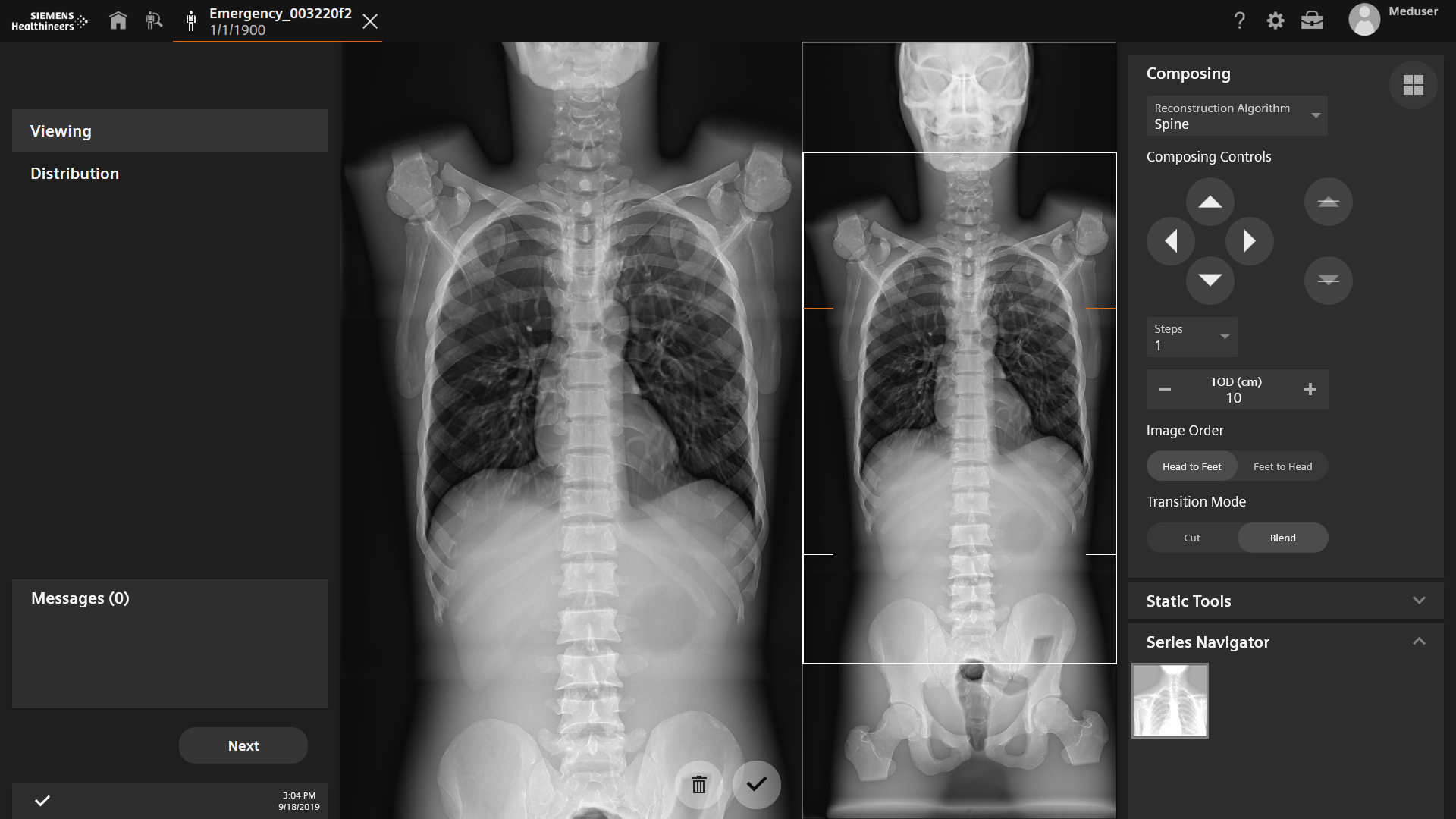 YSIO X.pree with myExam Companion - Siemens Healthineers