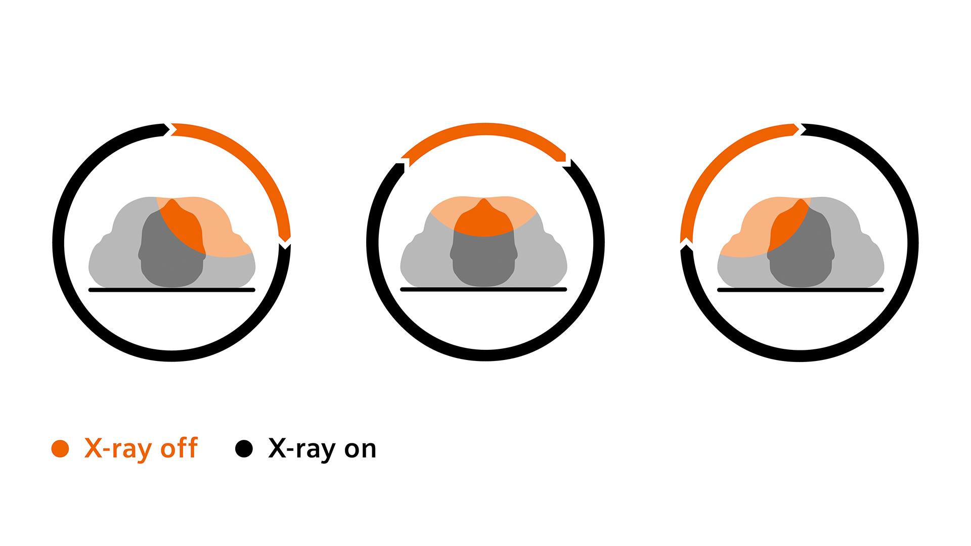 CT-guided interventions - Siemens Healthineers