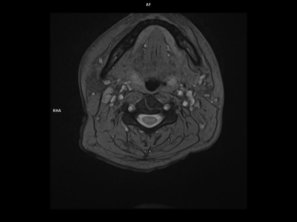 Axial T2* MEDIC -MAGNETOM Altea - Siemens Healthineers USA