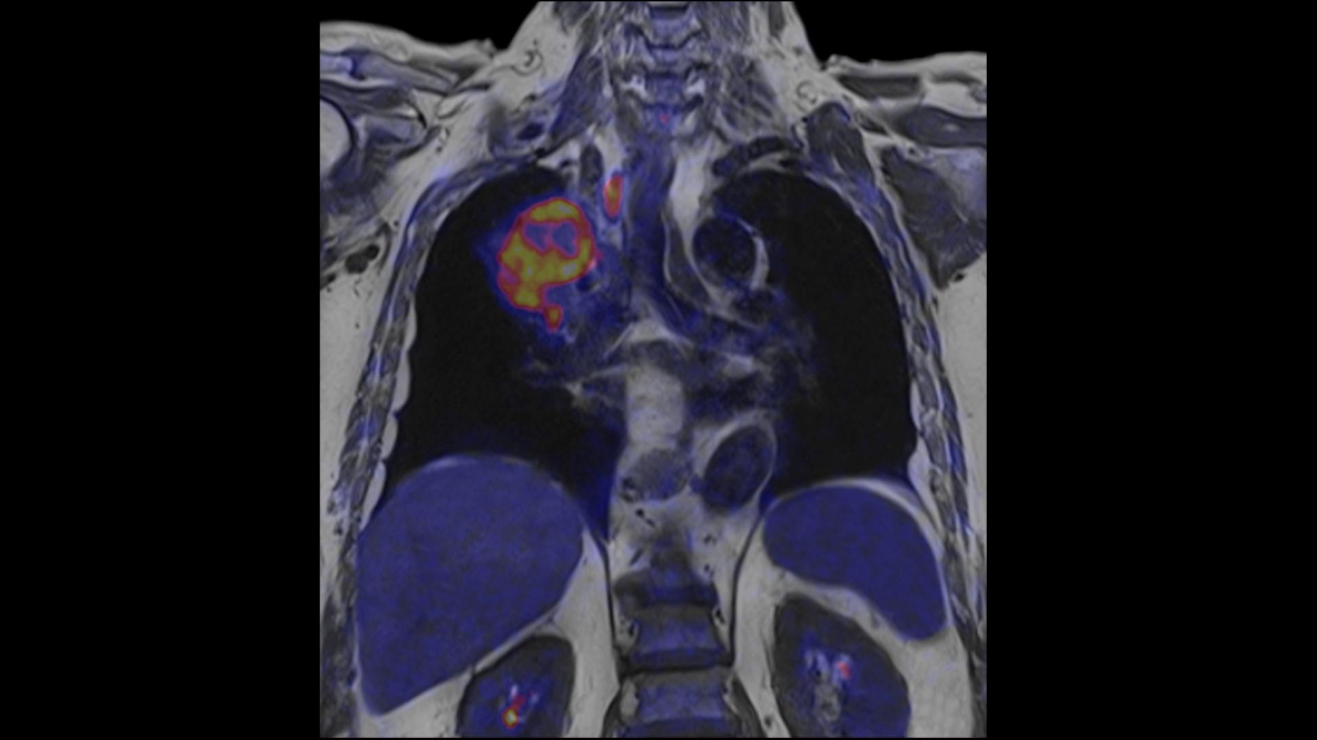 Biograph mMR – Simultaneous MR-PET scanner - Siemens Healthineers Schweiz