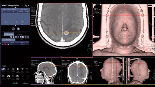 syngo.via RT Image Suite - Siemens Healthineers Česká republika