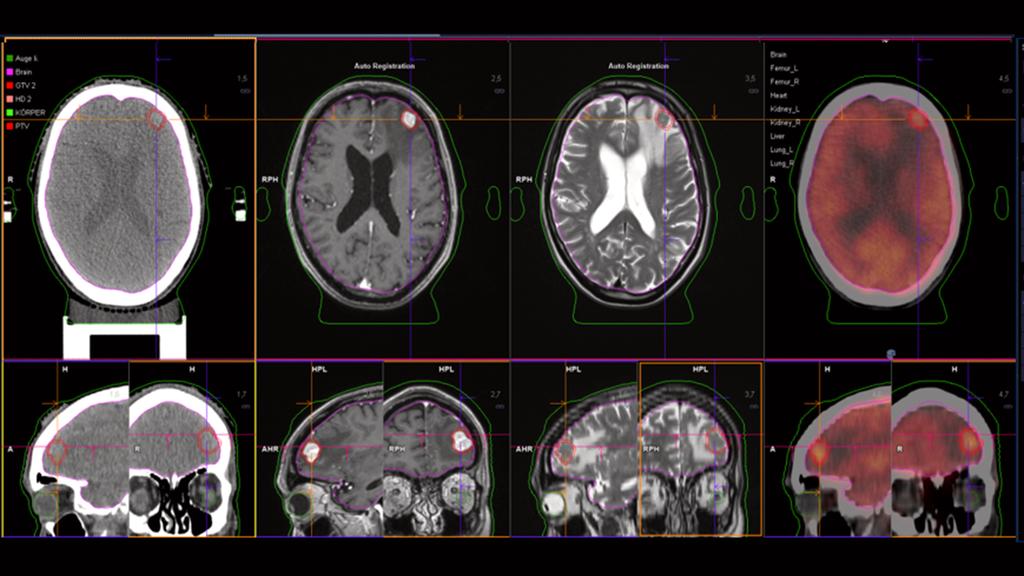 syngo.via RT Image Suite