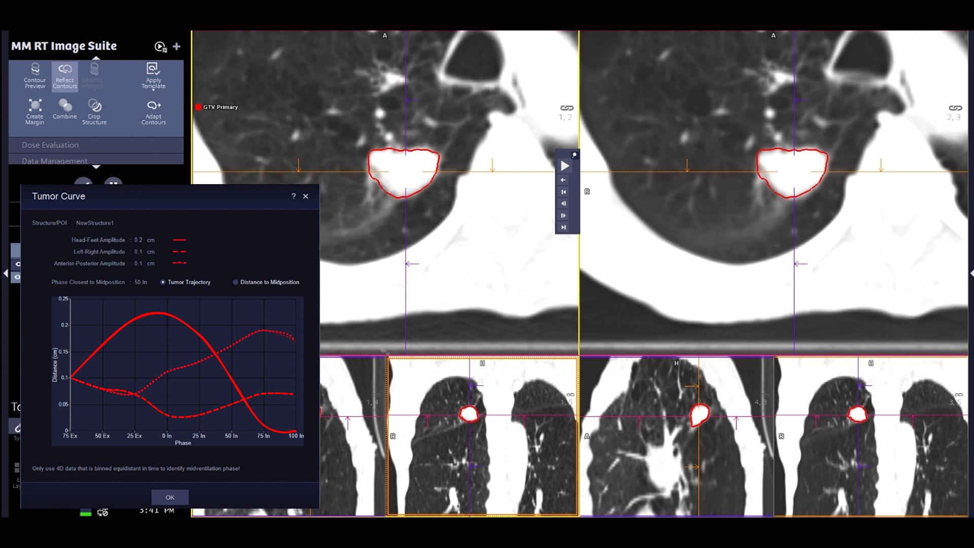 syngo.via RT Image Suite