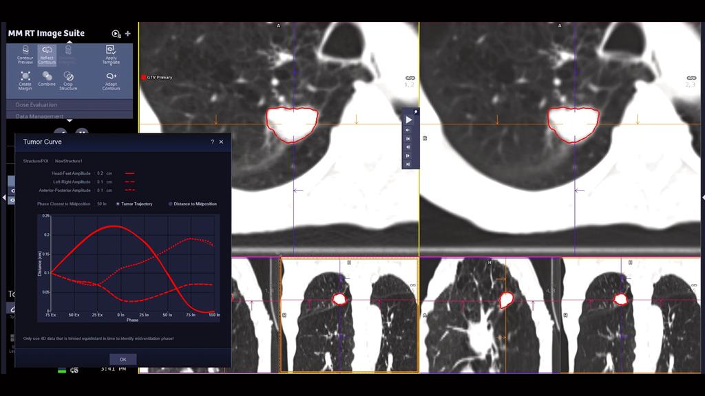 syngo.via RT Image Suite