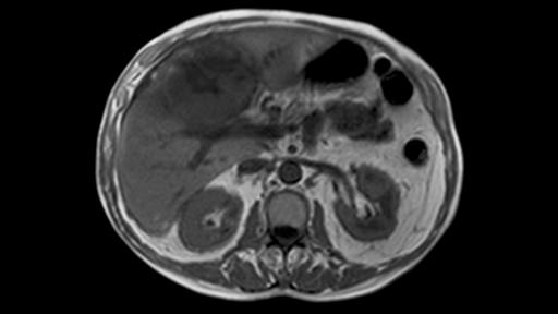 MAGNETOM Aera - Siemens Healthineers USA