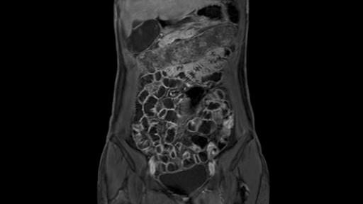 MAGNETOM Aera - Siemens Healthineers USA