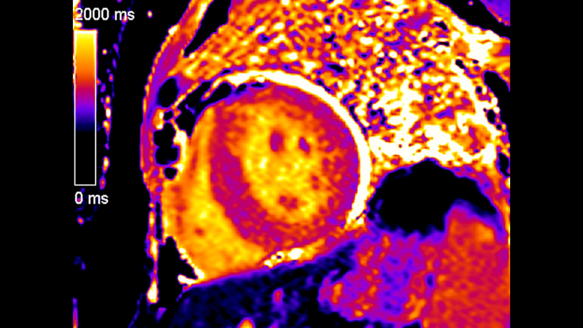 MAGNETOM Aera - Siemens Healthineers USA