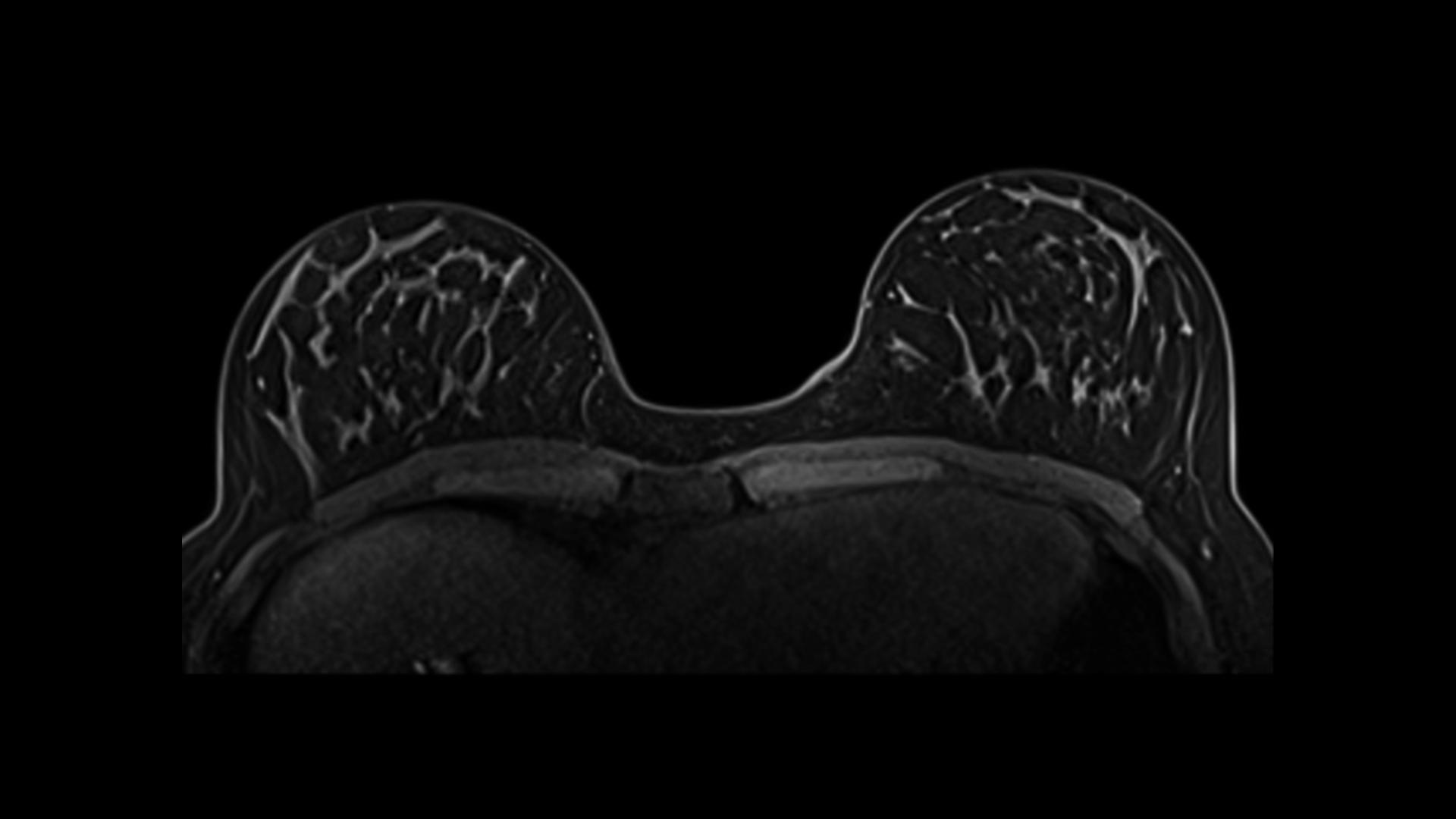 MAGNETOM Aera - Siemens Healthineers USA