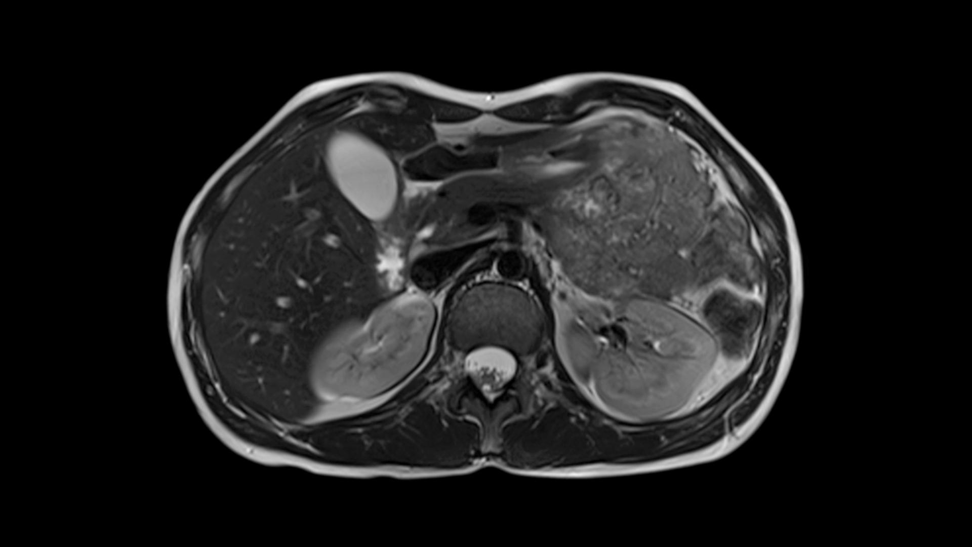 MAGNETOM Skyra eco - Siemens Healthineers USA