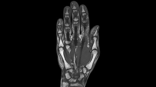 MAGNETOM Skyra eco - Siemens Healthineers USA