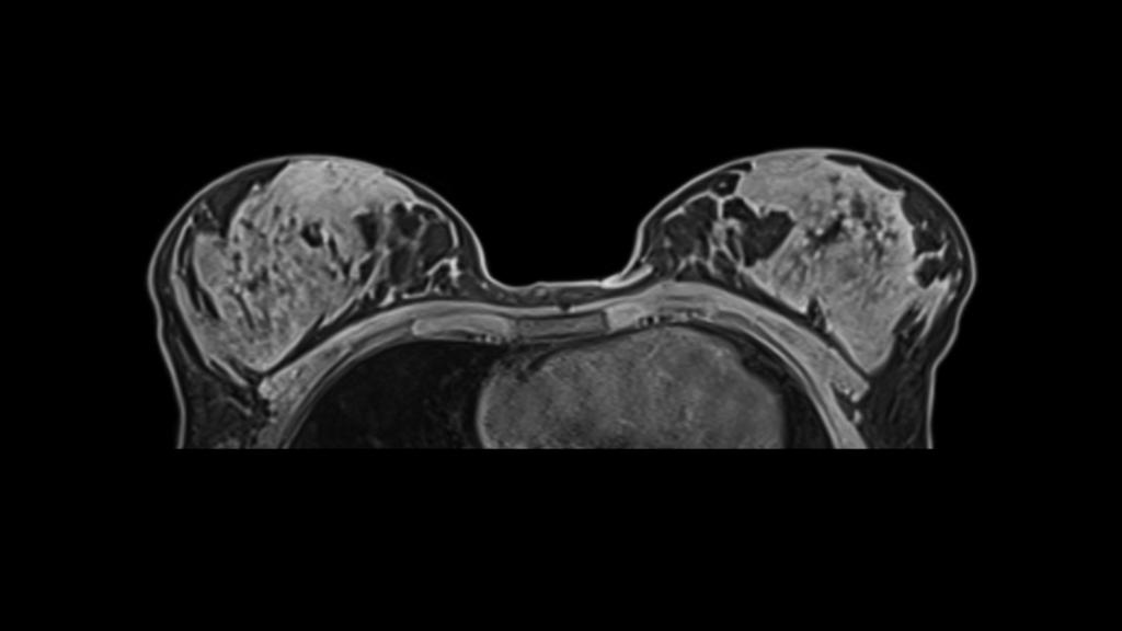 MAGNETOM Skyra eco - Siemens Healthineers USA