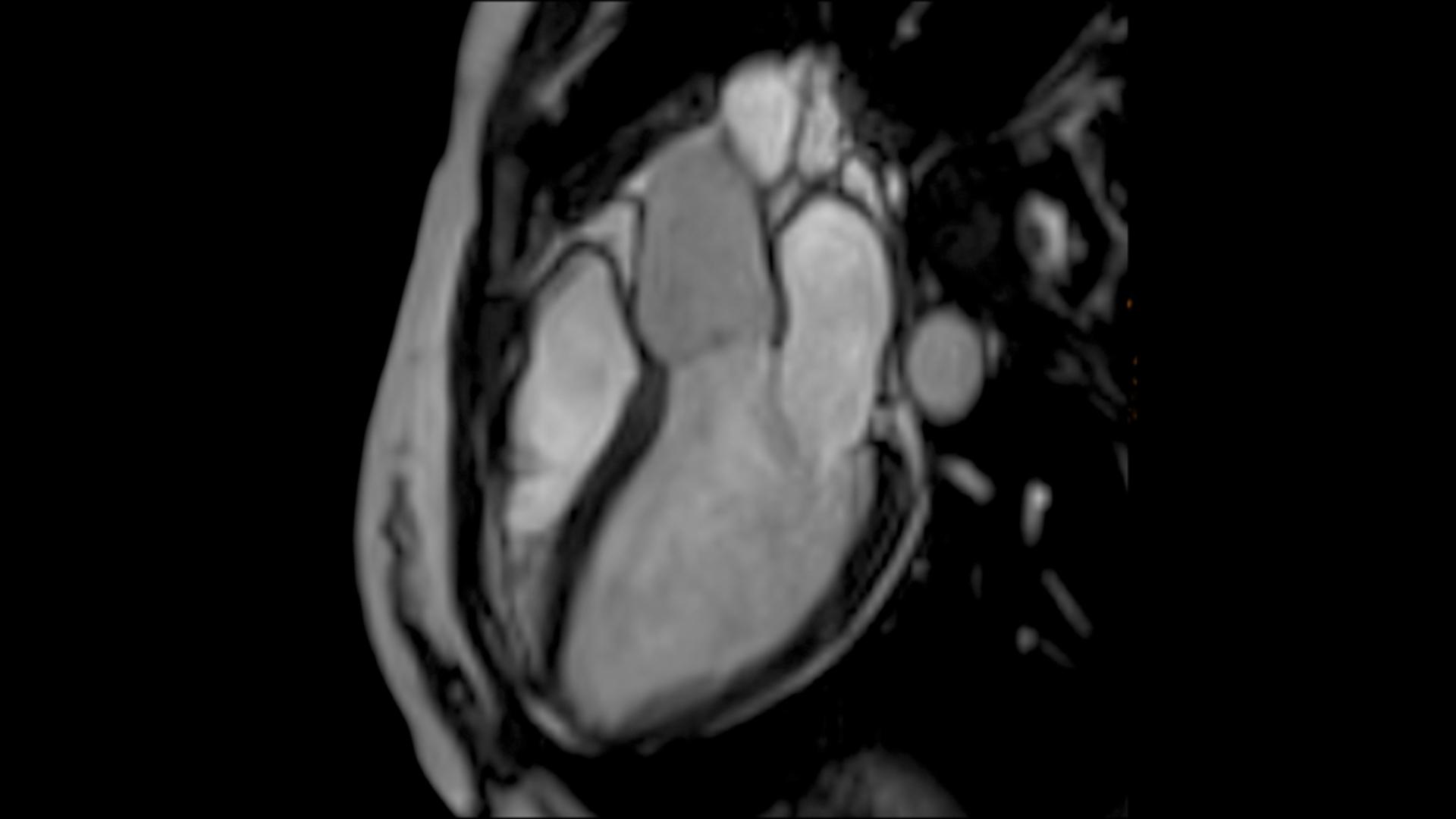 Pulse Check: Mastering MRI for the Heart - Siemens Healthineers Phillipines