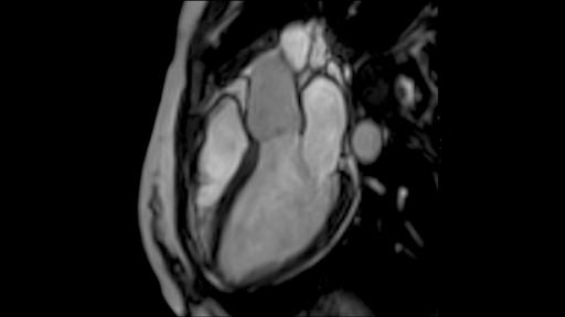 Pulse Check: Mastering MRI for the Heart - Siemens Healthineers Phillipines