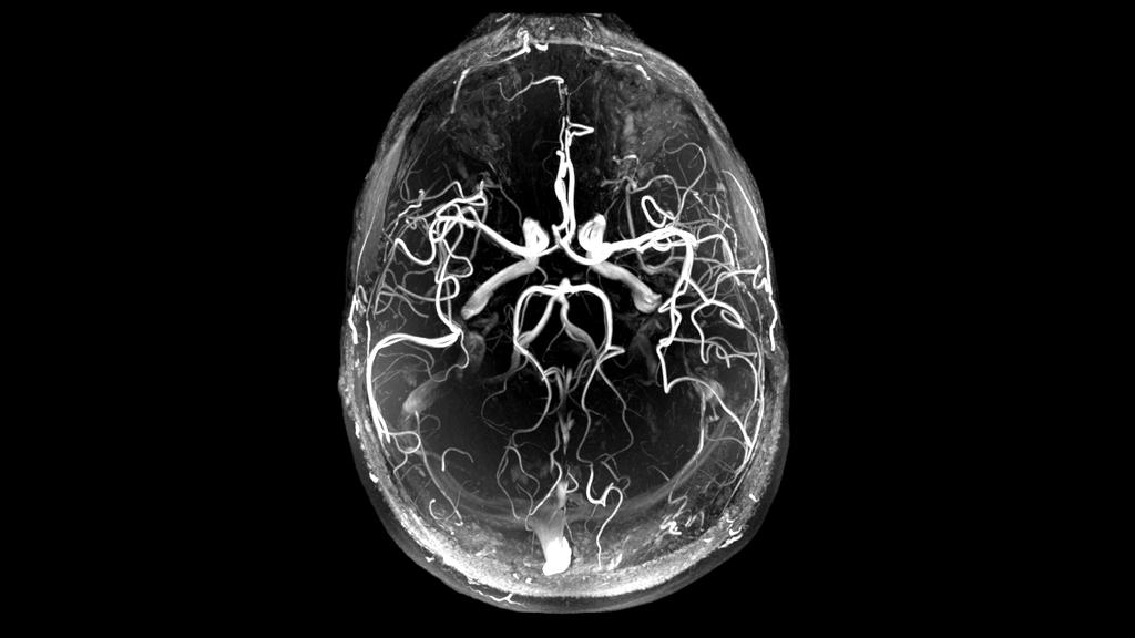 MAGNETOM Terra – 7T MRI Scanner - Siemens Healthineers India
