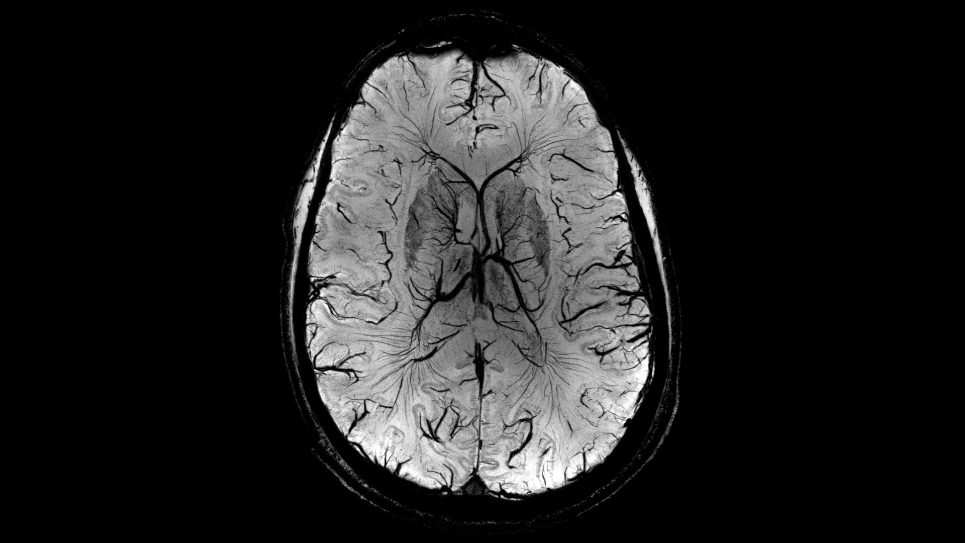 MAGNETOM Terra – 7T MRI Scanner - Siemens Healthineers India