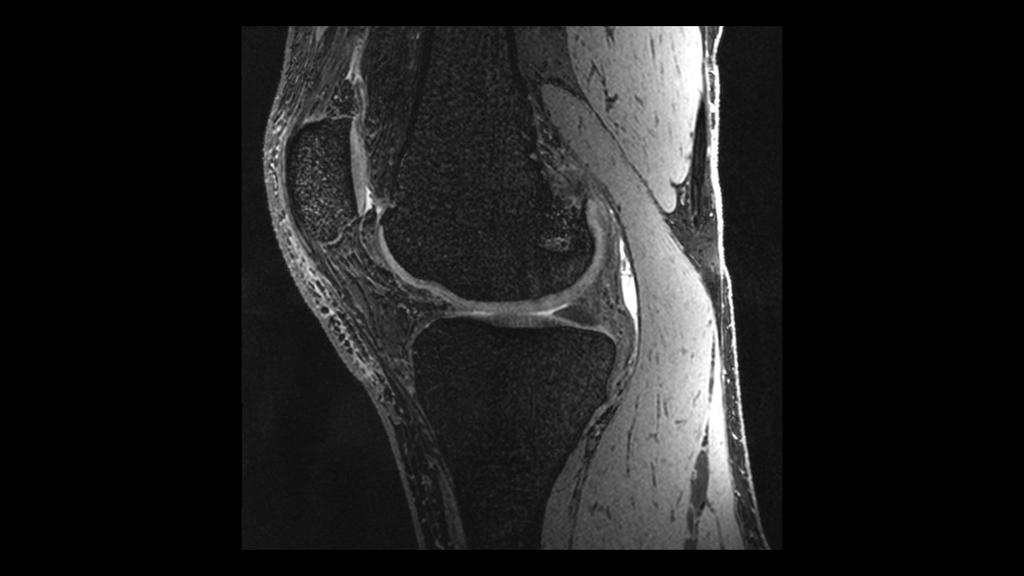 MAGNETOM Terra – 7T MRI Scanner - Siemens Healthineers India