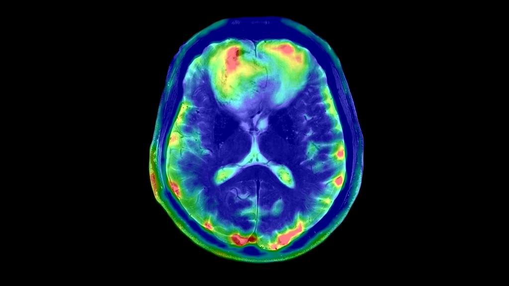 MAGNETOM Terra – 7T MRI Scanner - Siemens Healthineers India