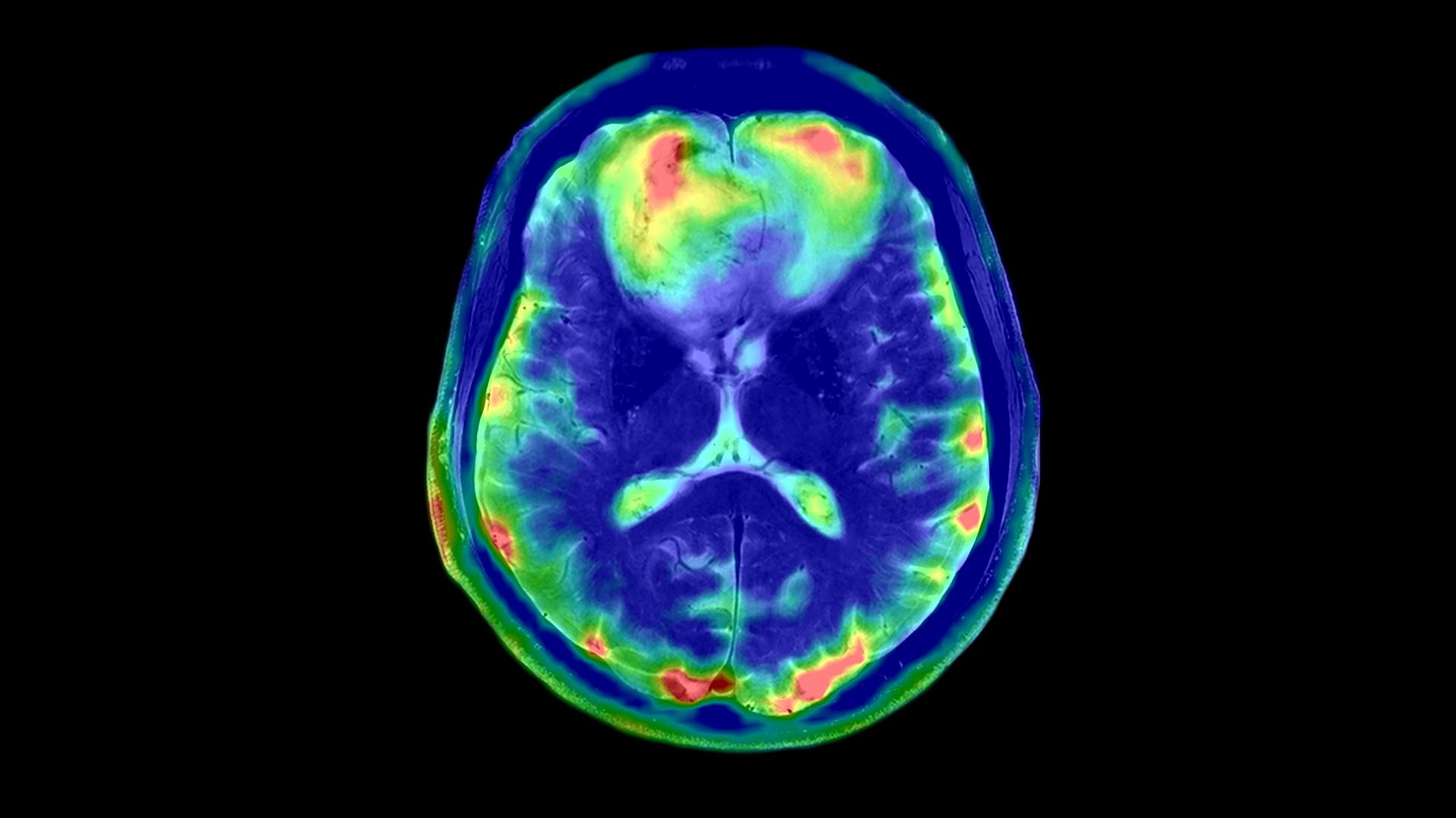 MAGNETOM Terra – 7T MRI Scanner - Siemens Healthineers India