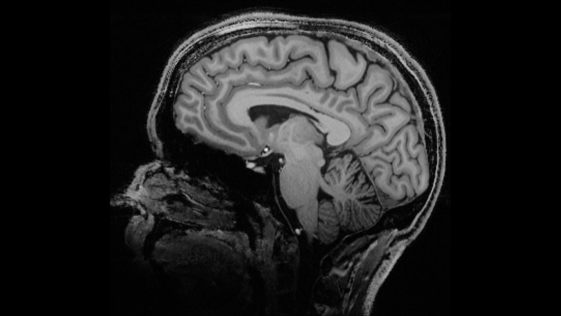 MAGNETOM Terra – 7T MRI Scanner - Siemens Healthineers India