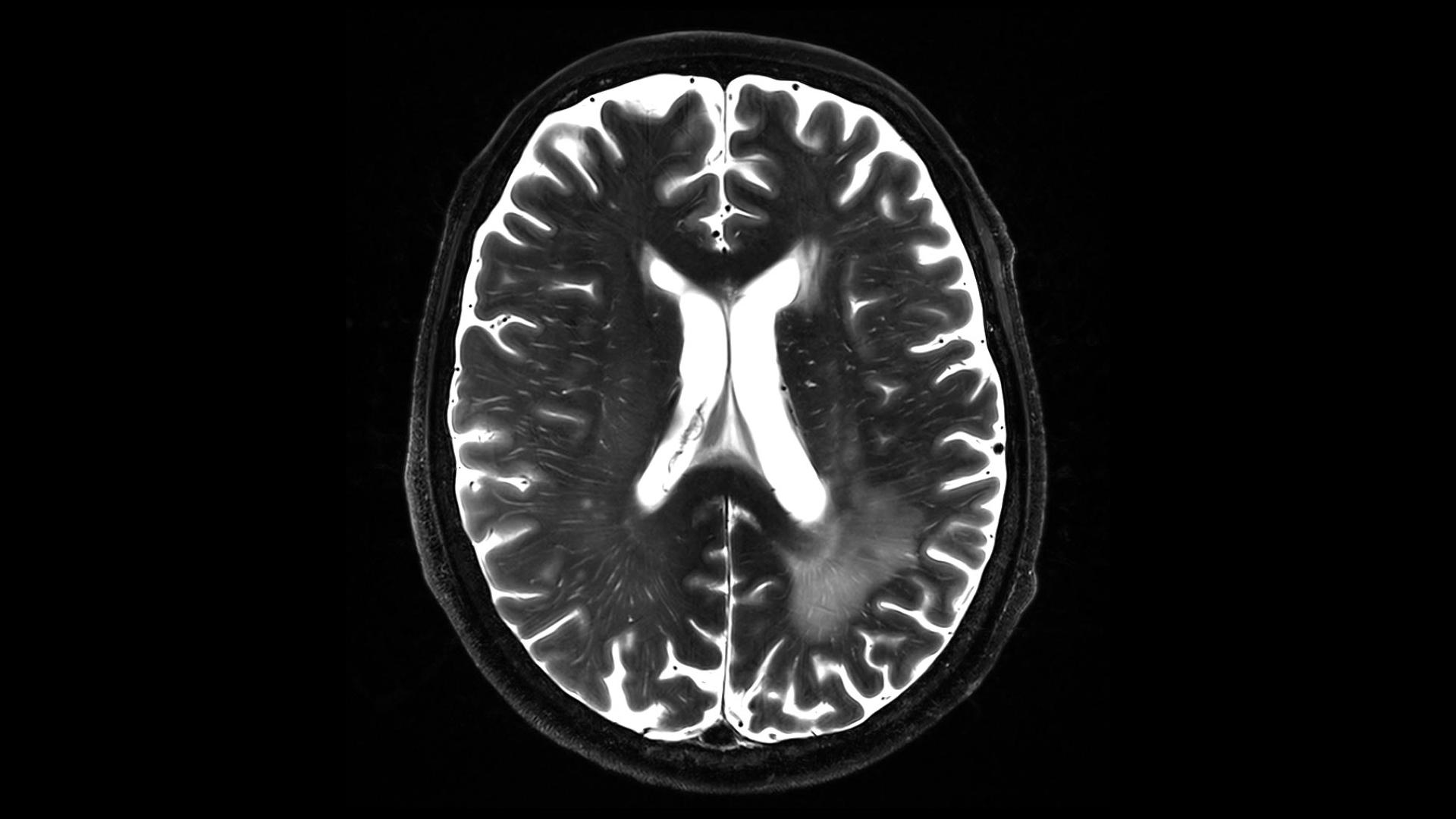 MAGNETOM Terra – 7T MRI Scanner - Siemens Healthineers India