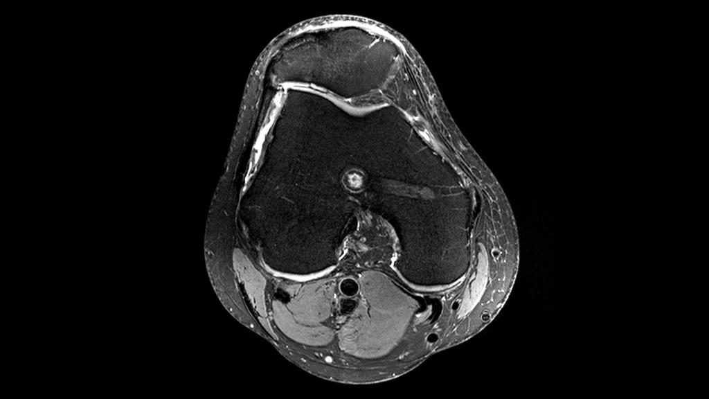 MAGNETOM Terra – 7T MRI Scanner - Siemens Healthineers India