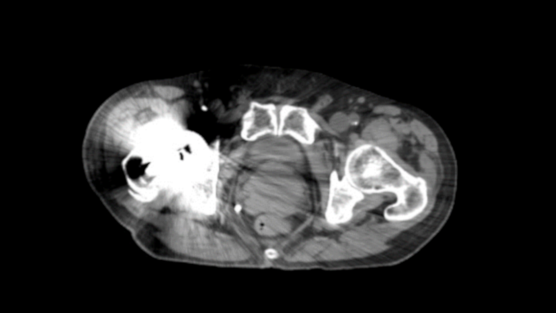 SOMATOM go.Sim - Siemens Healthineers