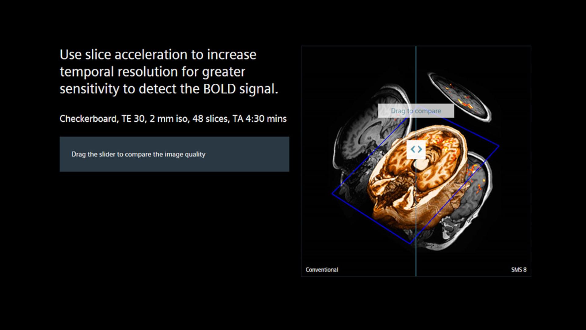 MR Neuro Imaging - MRI Neurology - Siemens Healthineers