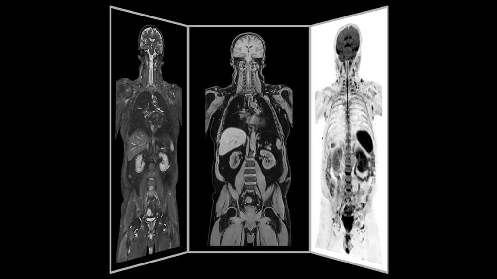 Body MRI - Siemens Healthineers