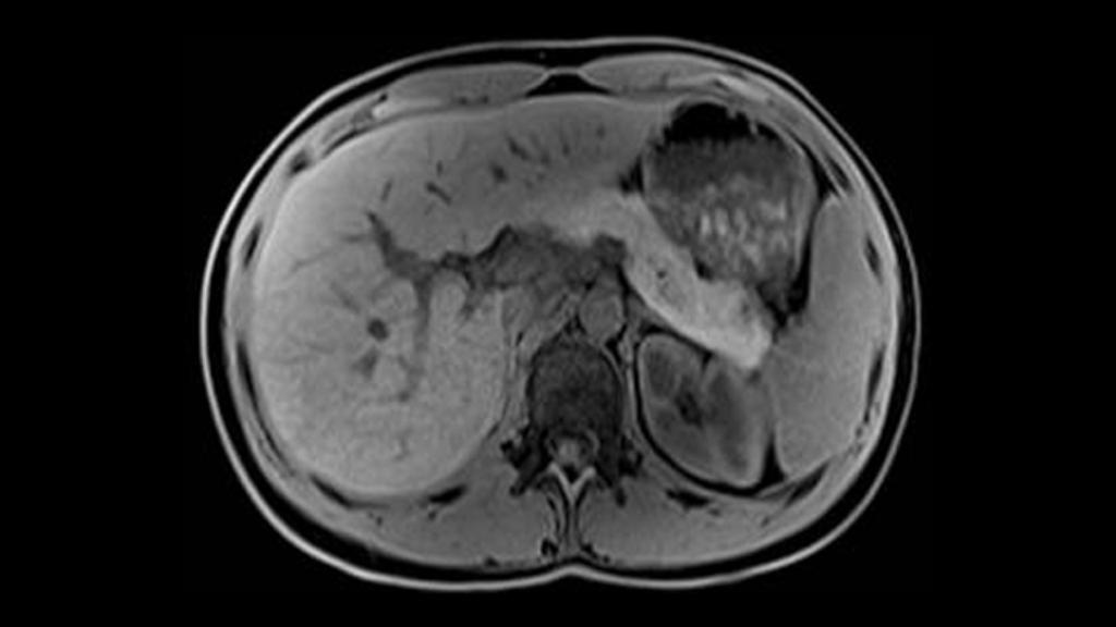 Pediatric MRI - Siemens Healthineers