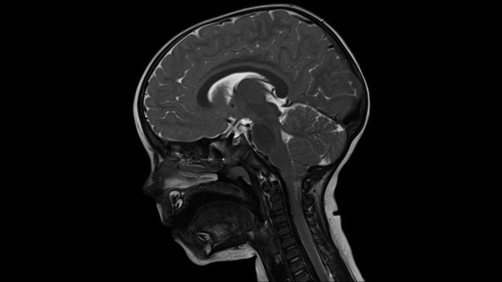 Pediatric MRI - Siemens Healthineers