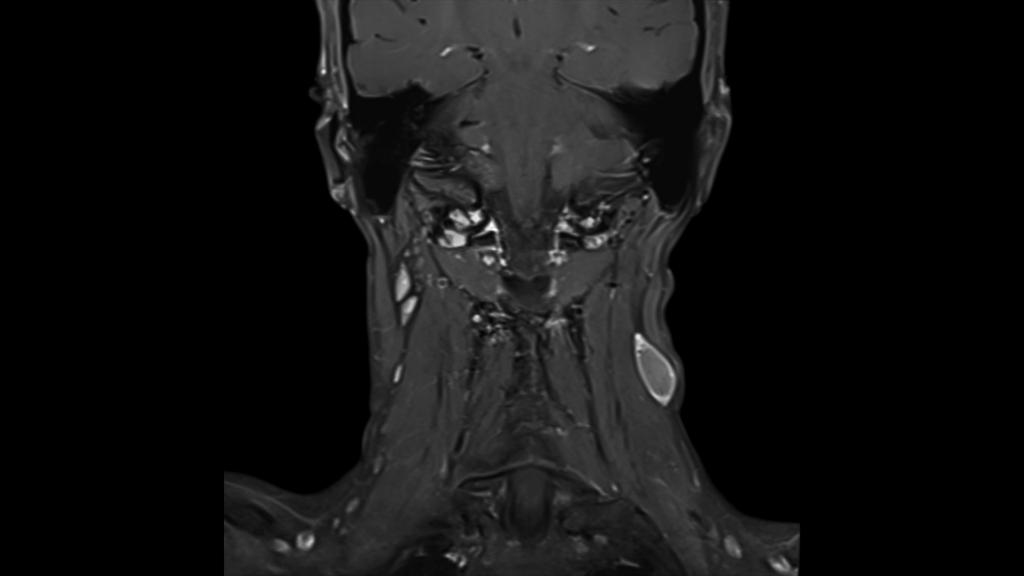 Pediatric MRI - Siemens Healthineers