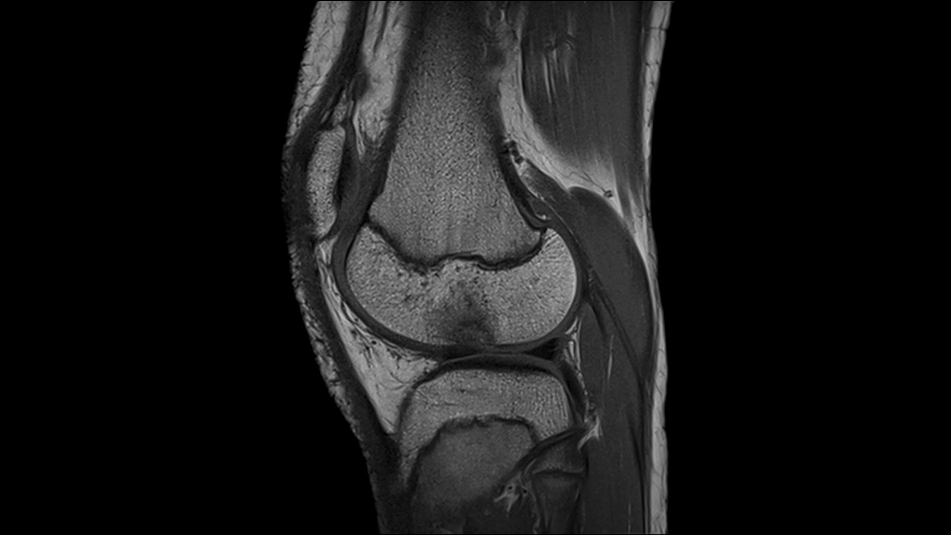 Pediatric MRI - Siemens Healthineers