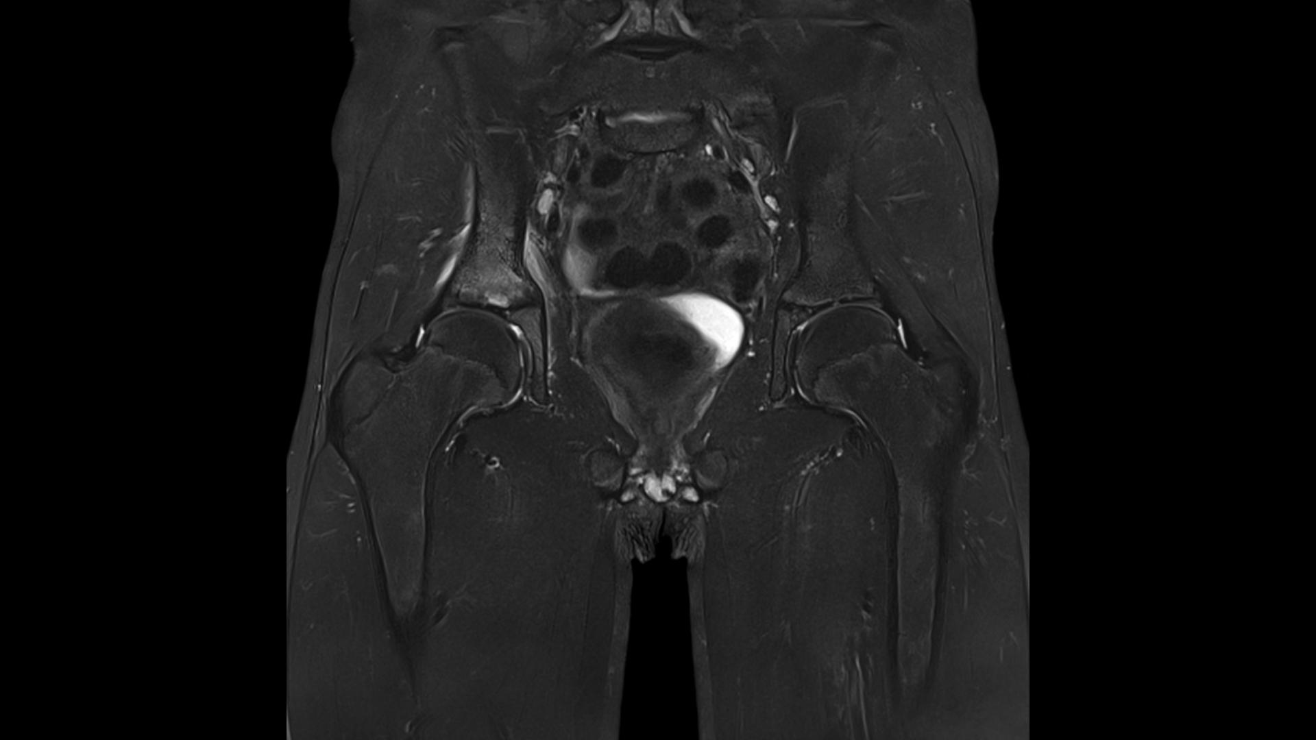 Pediatric MRI - Siemens Healthineers